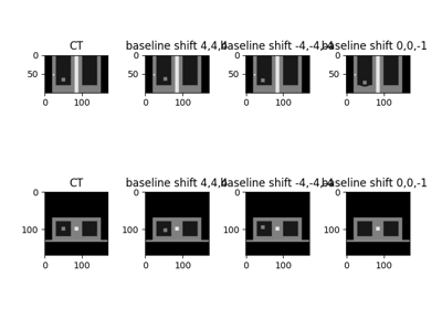 Example Gallery — OpenTPS examples documentation